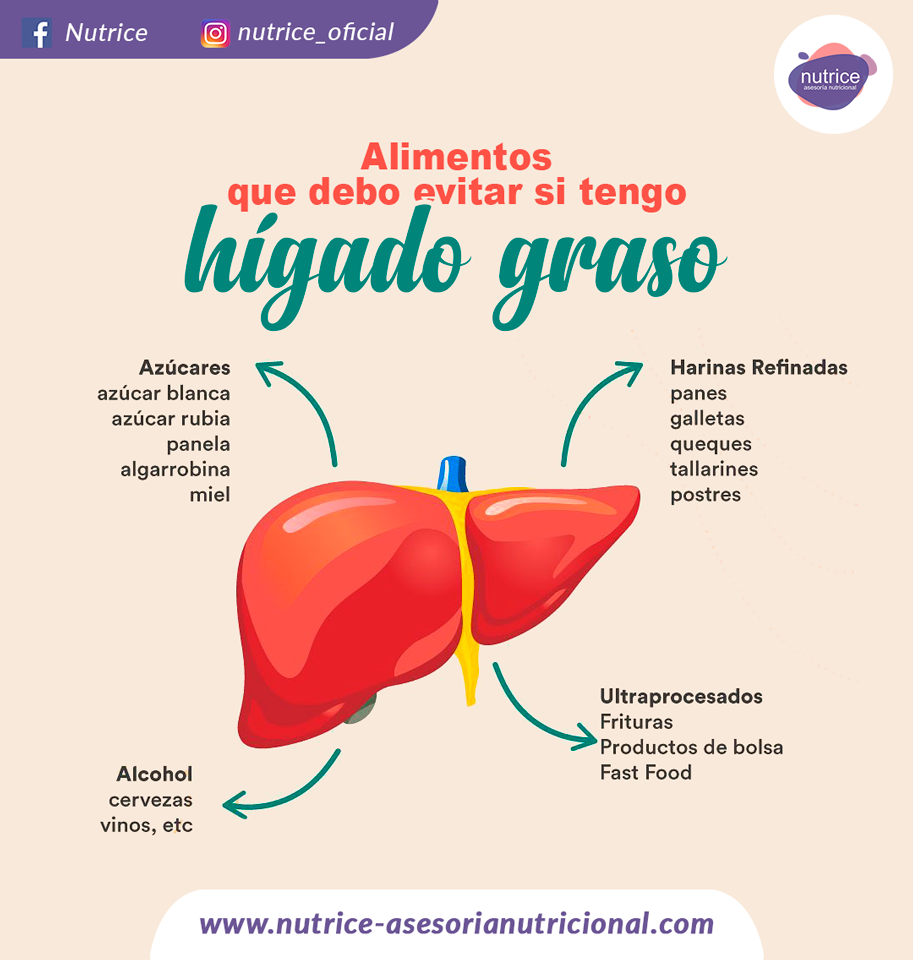 El hígado graso | Nutriceperu